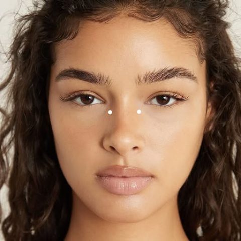 Treat Bunny Lines with Anti-Wrinkle Injections